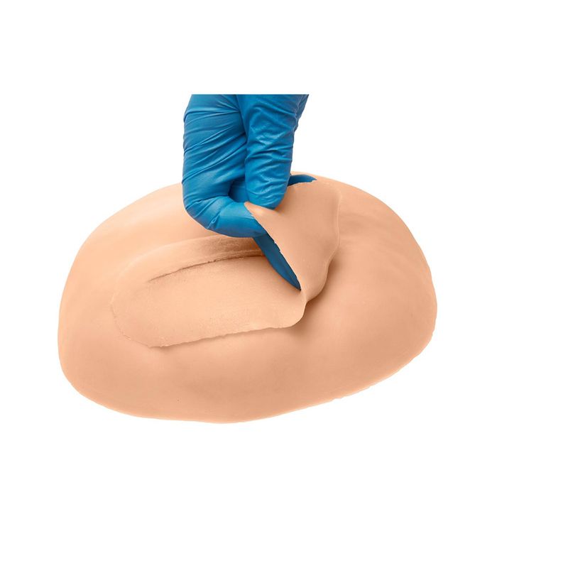 Cesarean Incision